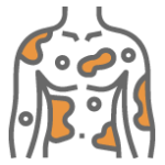 Pathologies couvertes - CNAM
